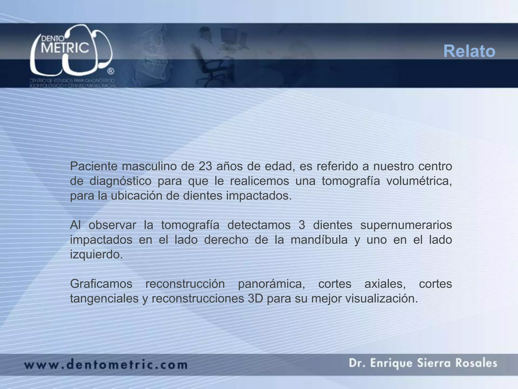 Multiples dientes supernumerarios | PPTX | Dental Health | Diseases and ...