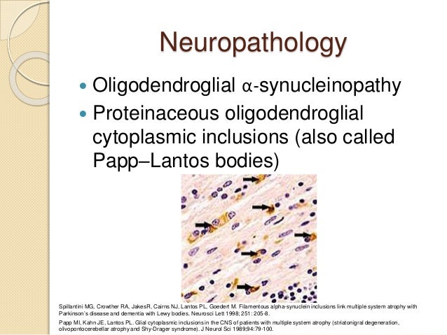Multiple System Atrophy