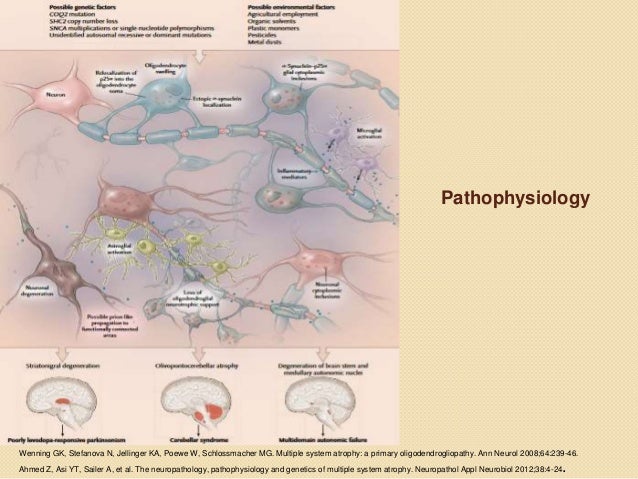 Multiple System Atrophy