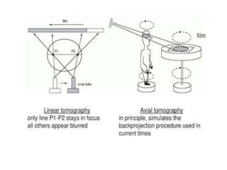Multisection tomography and Transaxial Tomography | PPTX