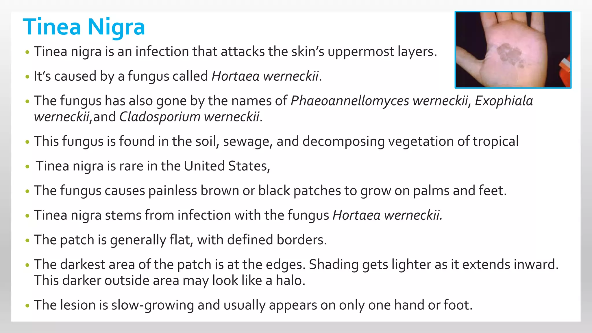 Superficial Mycoses Disease | PDF | Skin and Dermatology | Diseases and ...