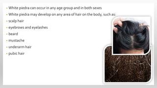 Superficial Mycoses Disease | PDF | Skin and Dermatology | Diseases and ...