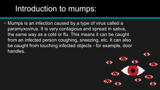 Mumps | PPT