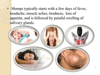 Mumps | PPTX | Infectious Diseases | Diseases and Conditions