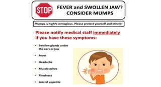 Mumps | PPTX | Ear, Nose and Throat Conditions | Diseases and Conditions