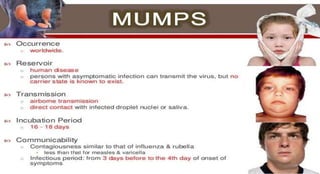 Mumps | PPTX | Ear, Nose and Throat Conditions | Diseases and Conditions
