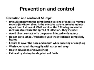 Mumps | PDF