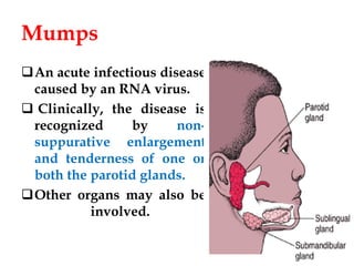 Mumps In Adults