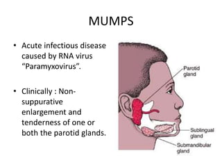 mumps.pptx | Infectious Diseases | Diseases and Conditions