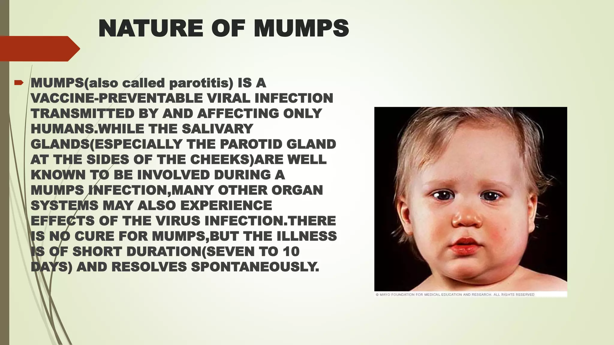 MUMPS | PPTX