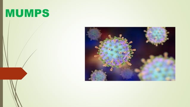 MUMPS | PPTX | Infectious Diseases | Diseases and Conditions