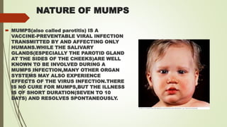 MUMPS | PPTX