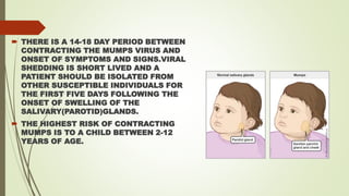 MUMPS | PPTX