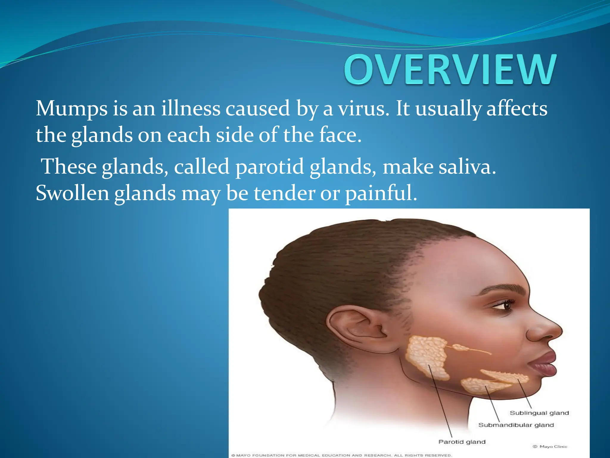MUMPS Department of Physiotherapy, SHUATS | PDF