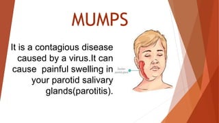 MUMPS ppt presentation pdf in detail assignment | PDF