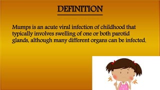 Mumps | PPTX