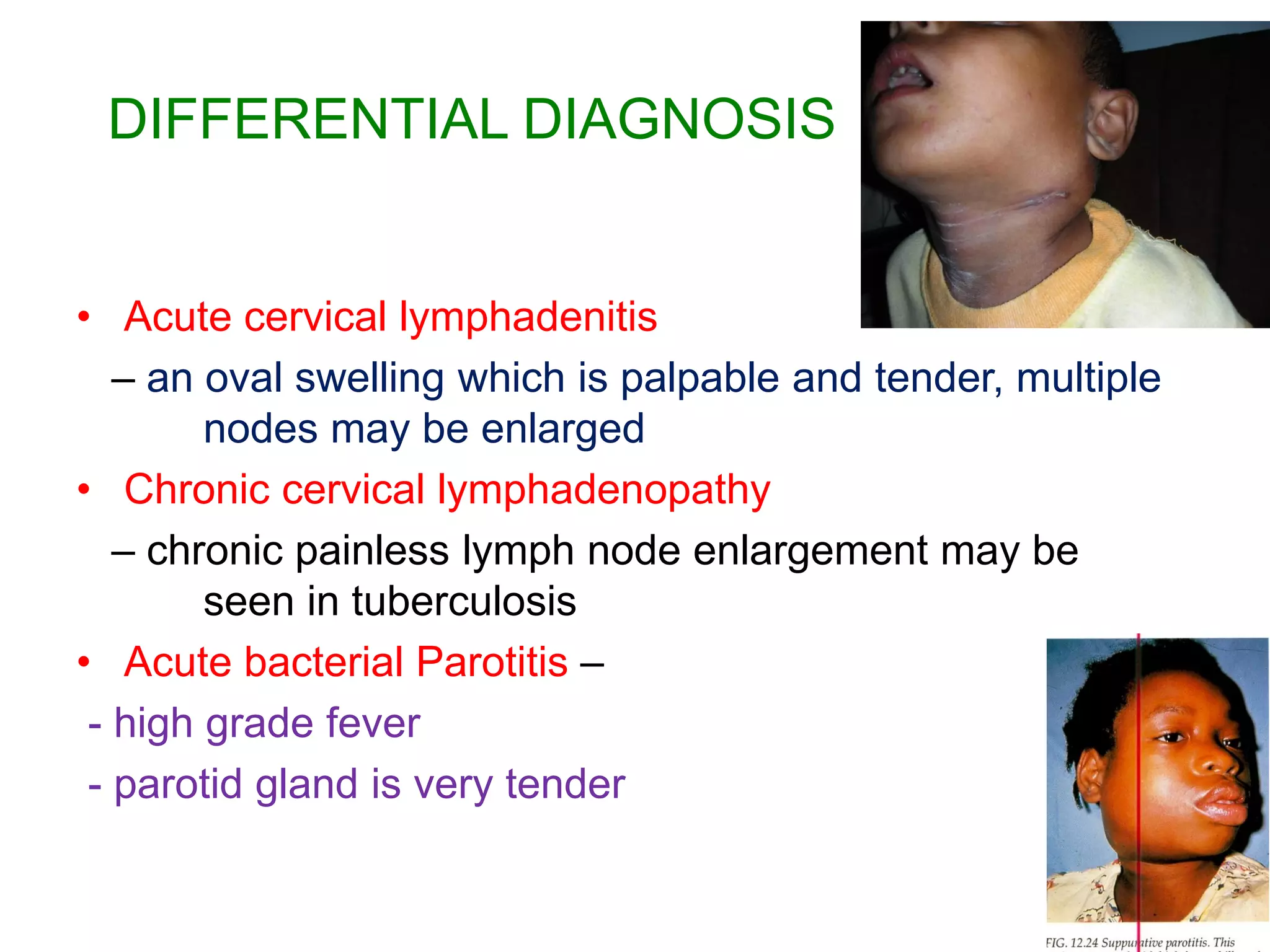 Mumps in children 2021 | PDF