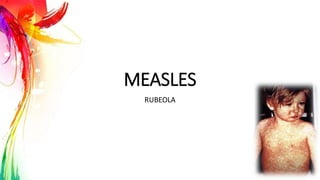 Mumps measles rubella | PPTX