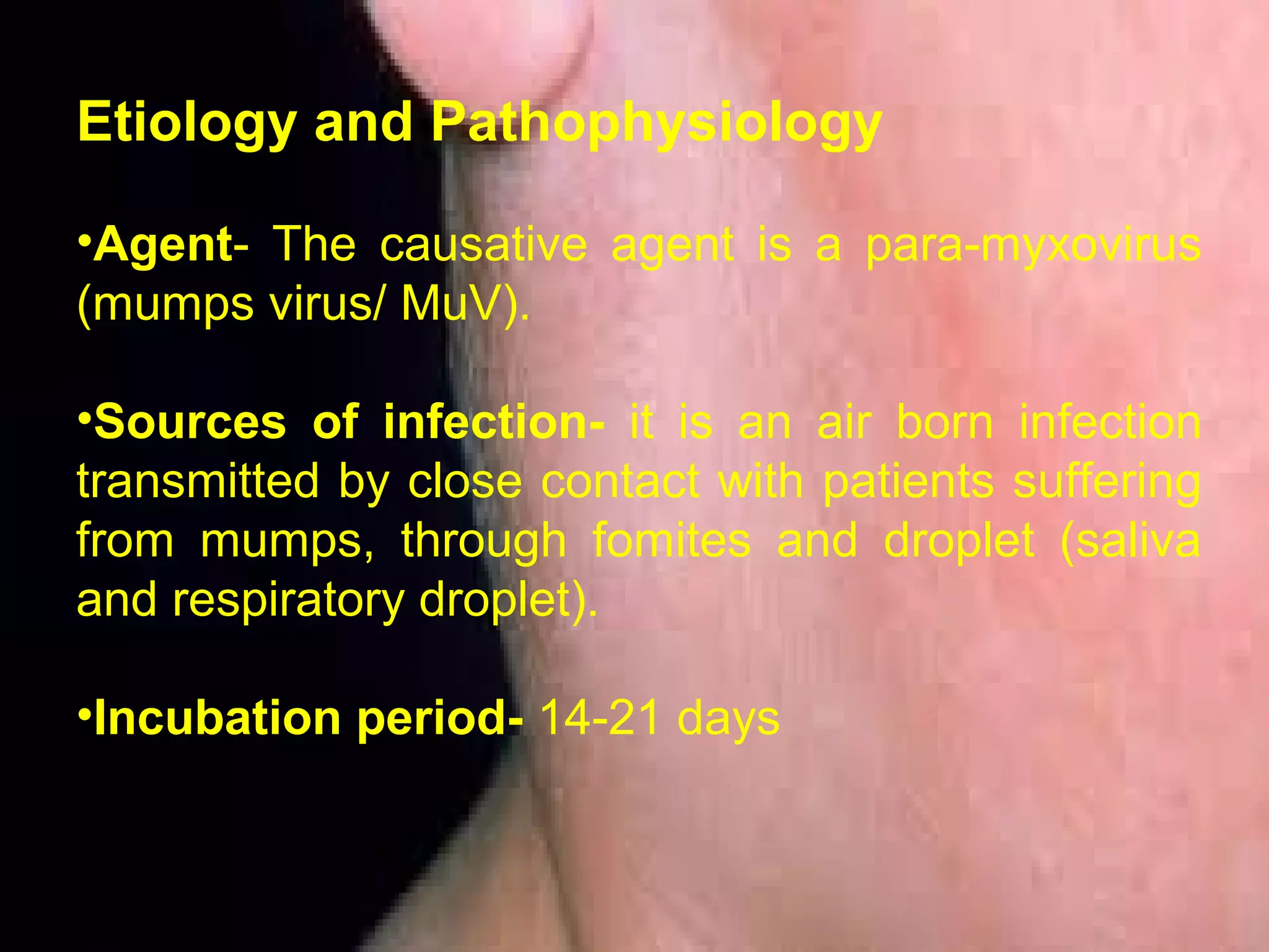 Mumps ppt biju | PPT