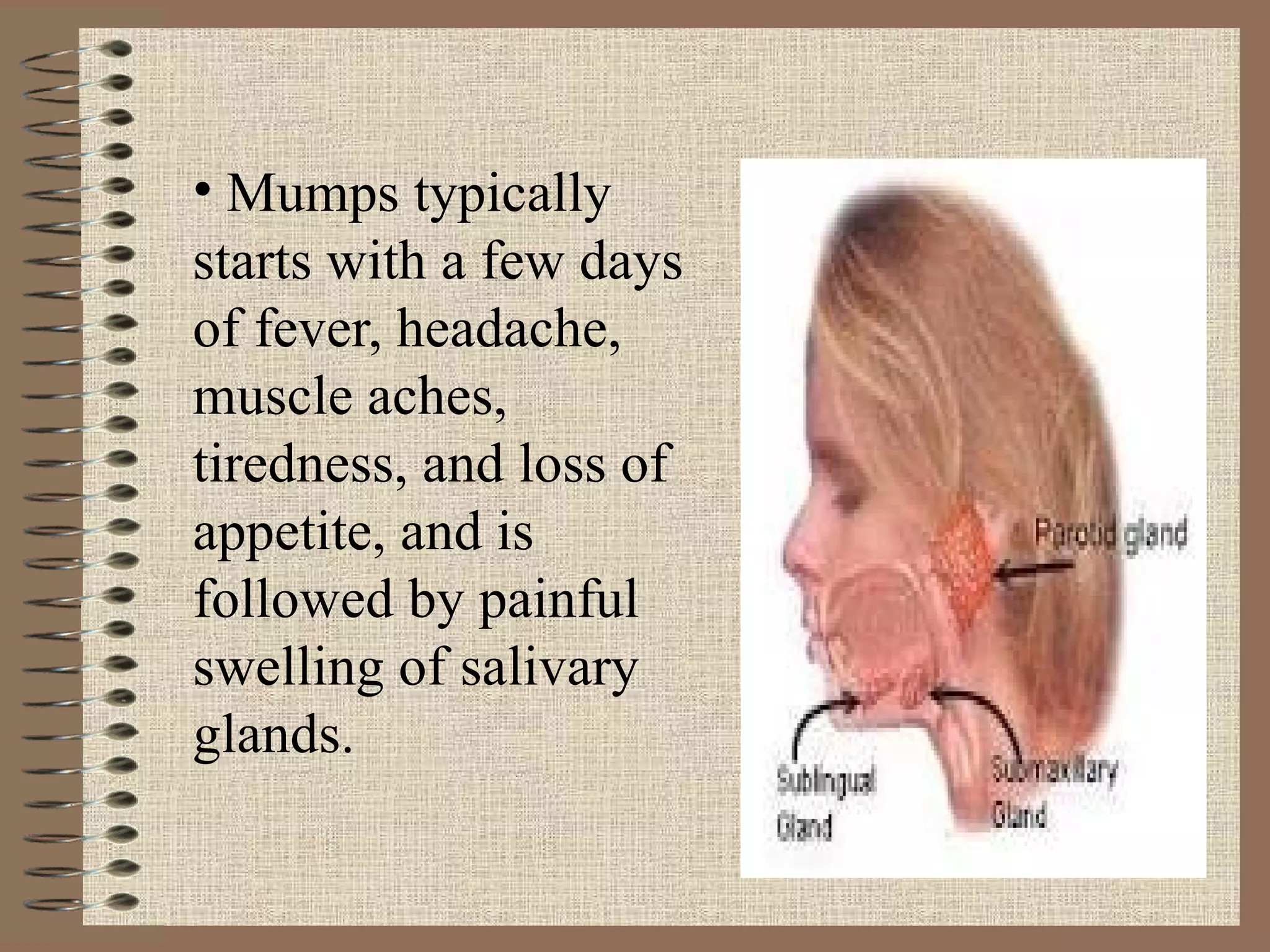 Mumps presentation s agun | PPT