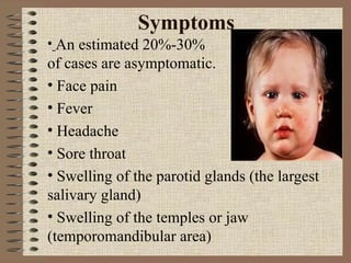 Mumps presentation s agun | PPT