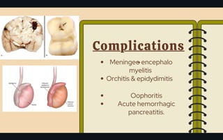 Mumps in children or epidemic parotitis) | PDF