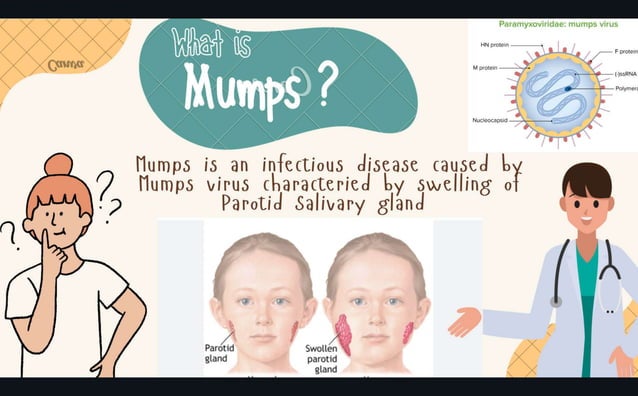 Mumps in children or epidemic parotitis) | PPT