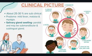 Mumps in children or epidemic parotitis) | PDF