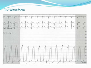 cath Lab Hemoduhynamic | PPTX