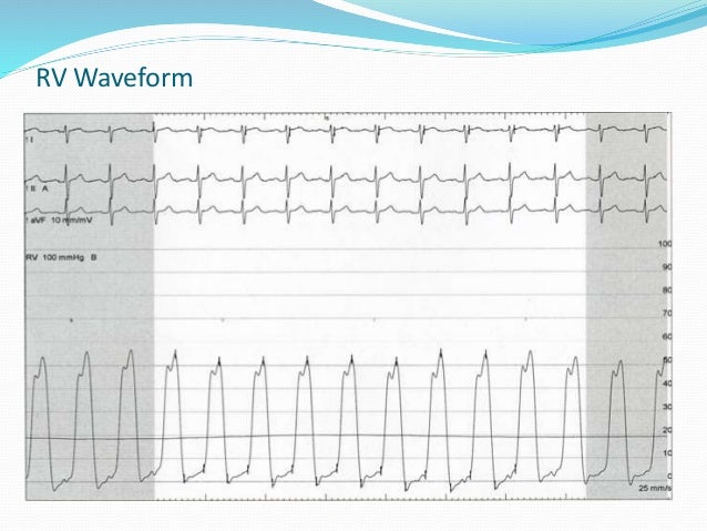 cath Lab Hemoduhynamic