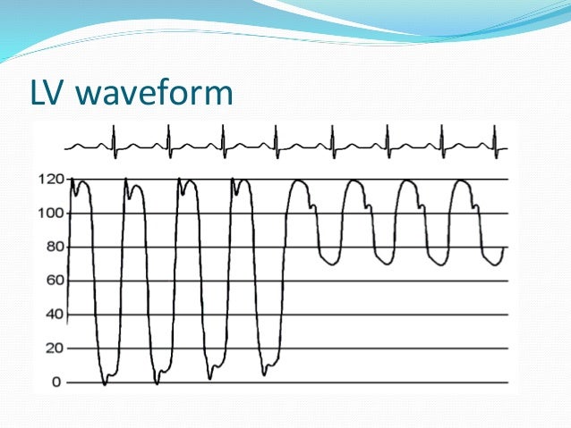 cath Lab Hemoduhynamic