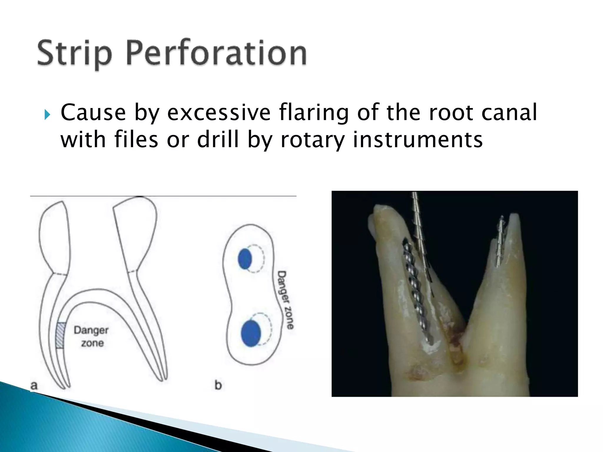 strip perforation | PPTX