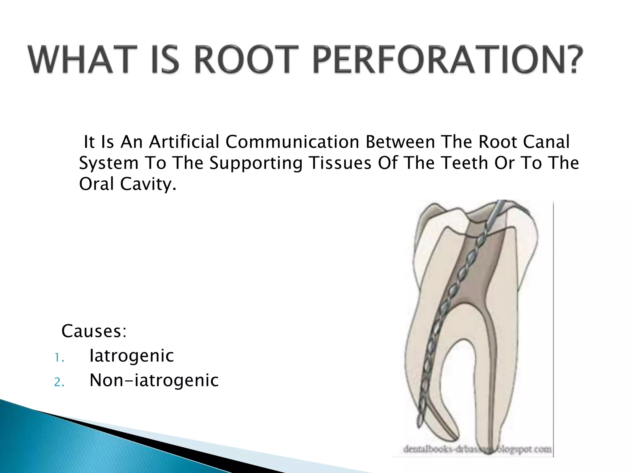 strip perforation | PPTX
