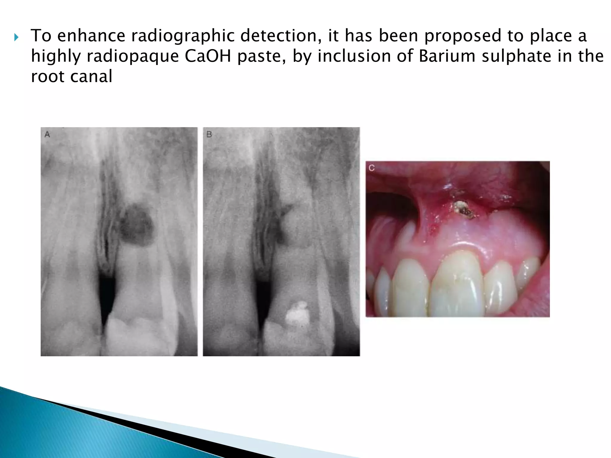 strip perforation | PPTX