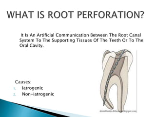 strip perforation | PPTX