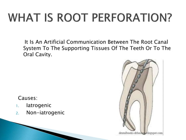 strip perforation | PPTX