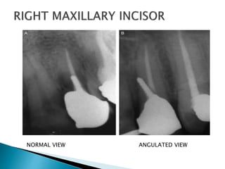 strip perforation | PPTX