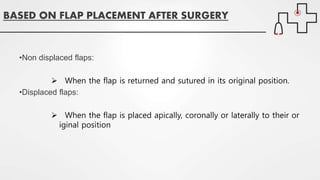 Flap surgery | PPTX
