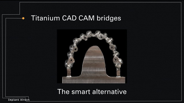 Titanium CAD Bridges with composite | PDF