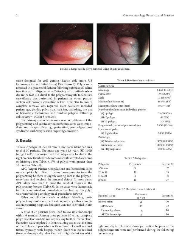 Cold Snare Polypectomy for Large Sessile Colonic Polyps: A Single-Cen…