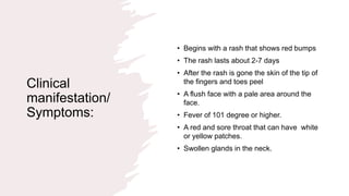 Scarlet fever Presentation.pptx
