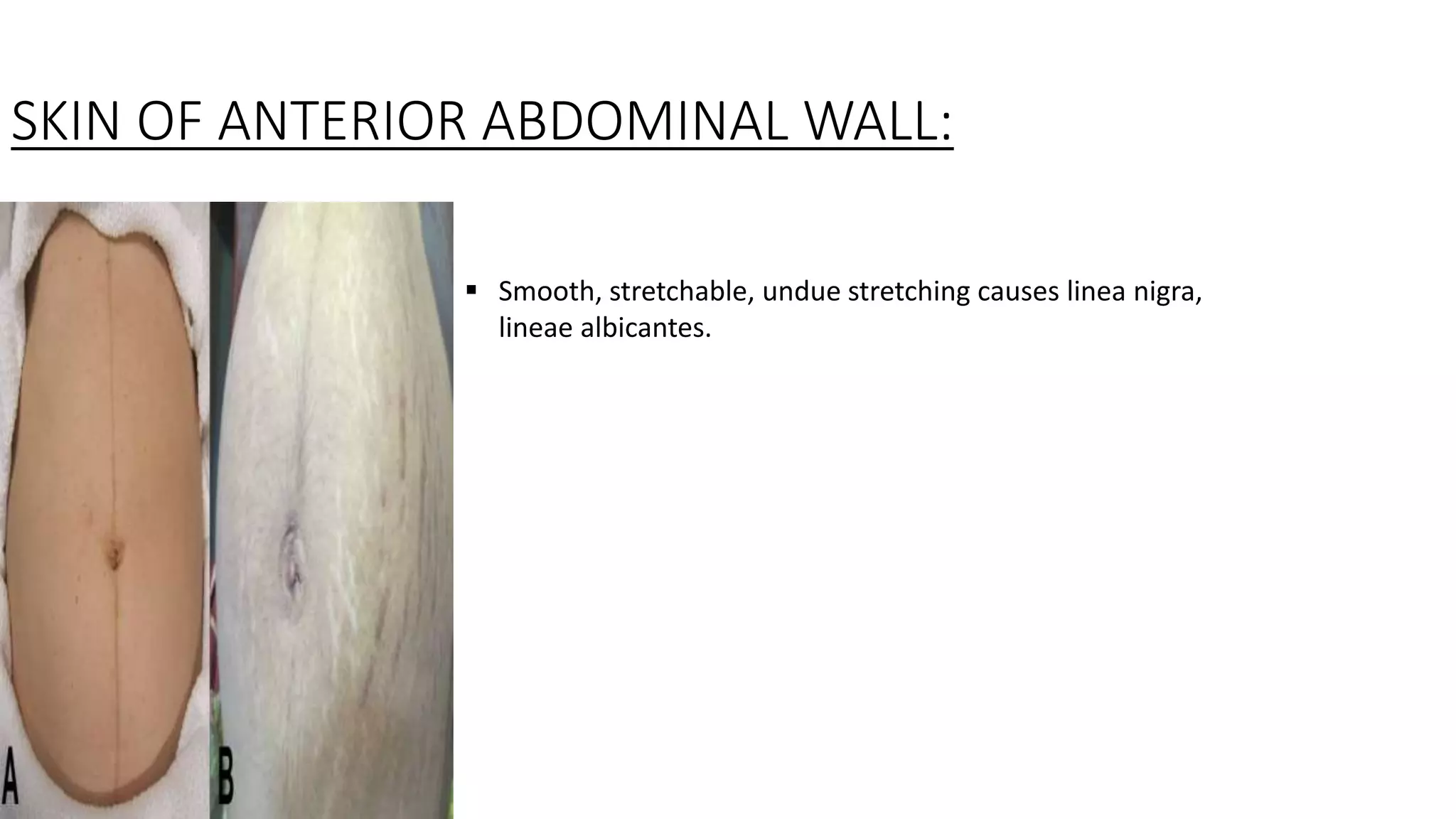 ANTERIOR ABDOMINAL WALL | PPTX