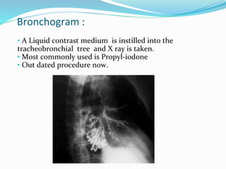 Murali bronchiectasis.pptx