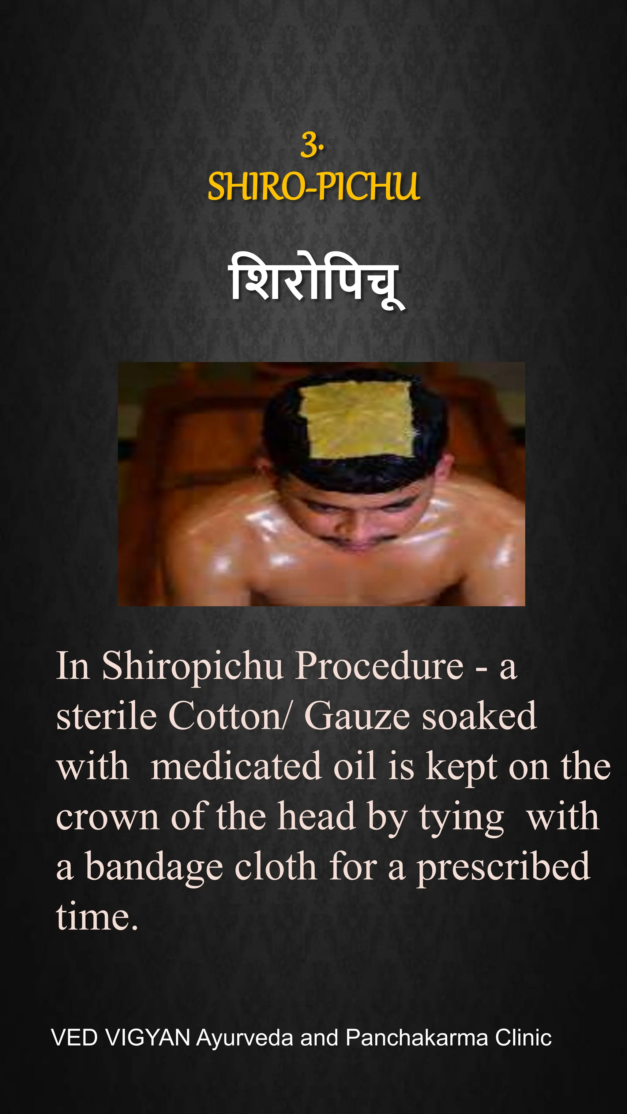 Types of murdhni taila, sequence of murdhni tail | PPTX