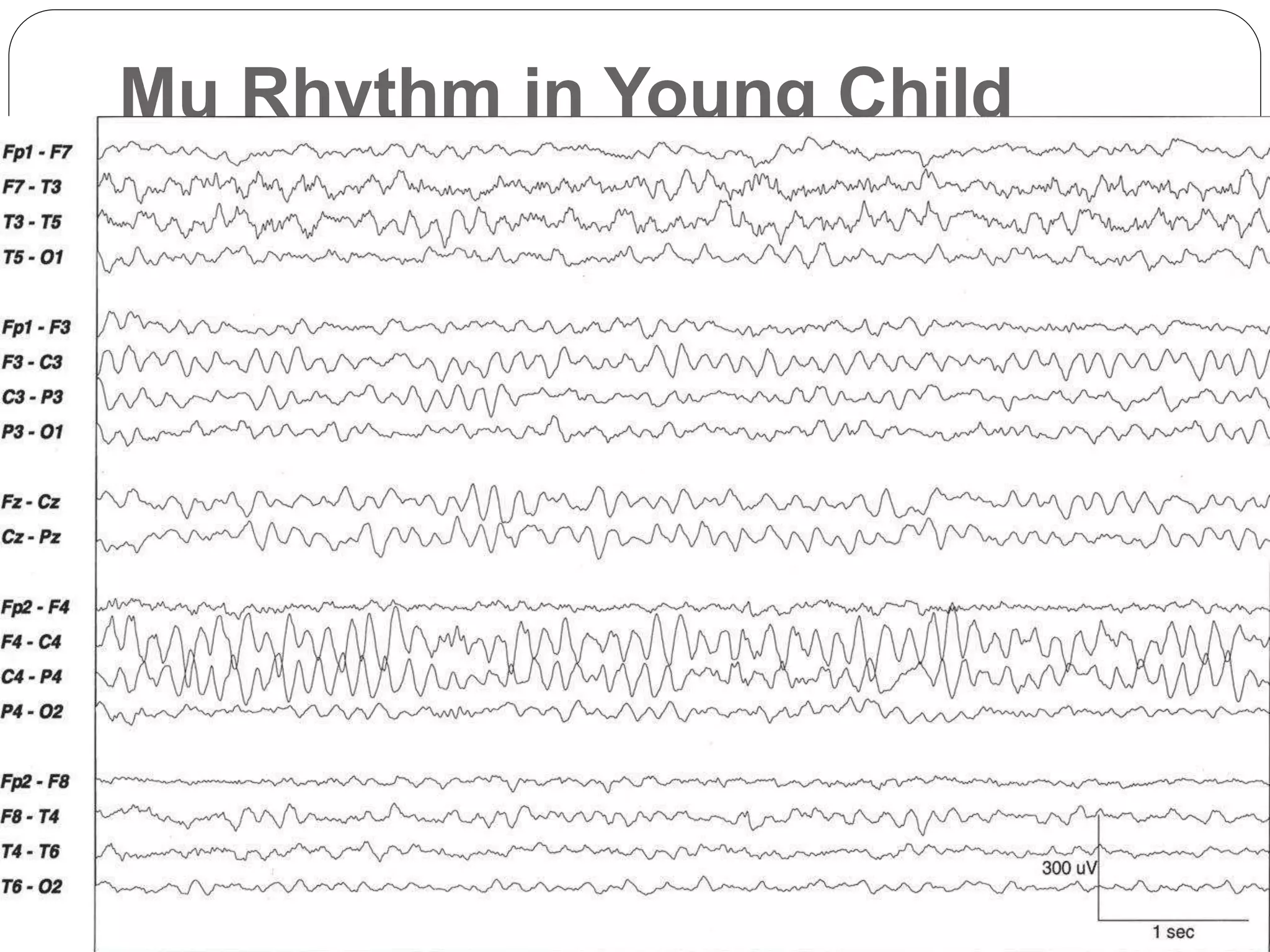 Mu rhythm | PPTX