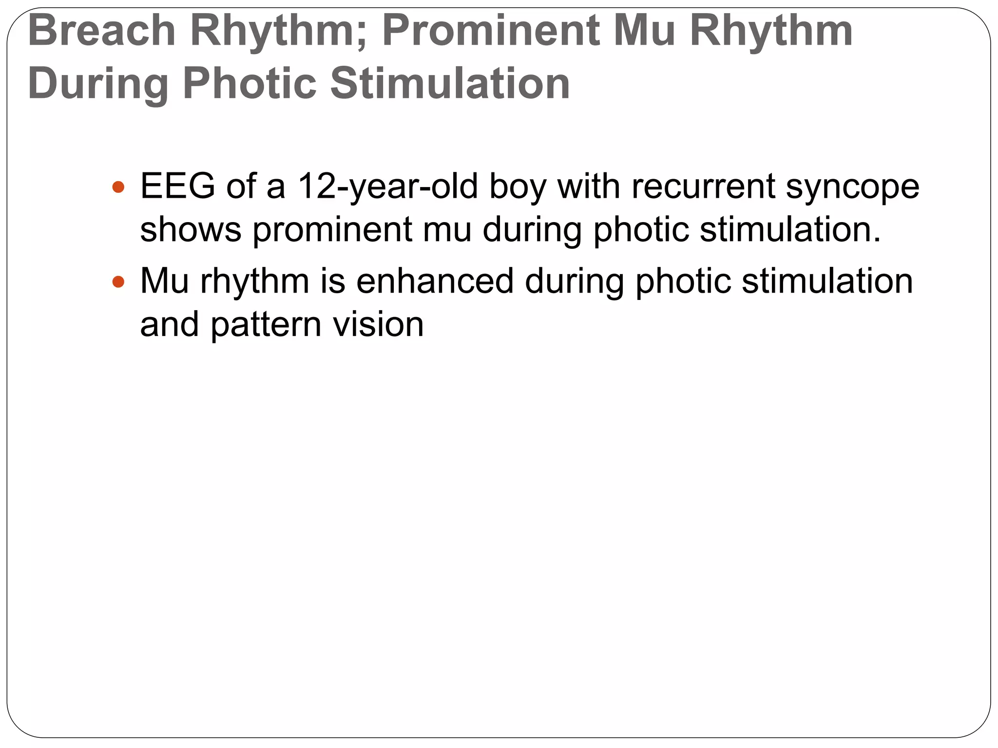 Mu rhythm | PPTX