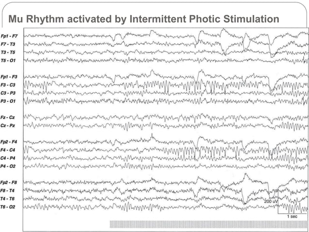 Mu rhythm | PPTX | Children\'s Music | Music
