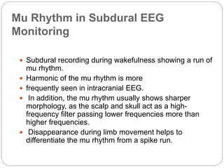 Mu rhythm | PPTX
