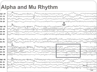 Mu rhythm | PPTX