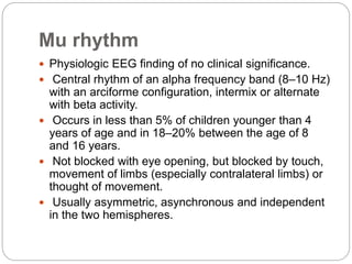Mu rhythm | PPT